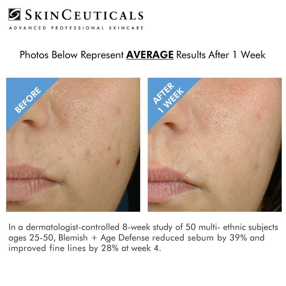Skinceuticals Blemish Age Defense TANGS Singapore